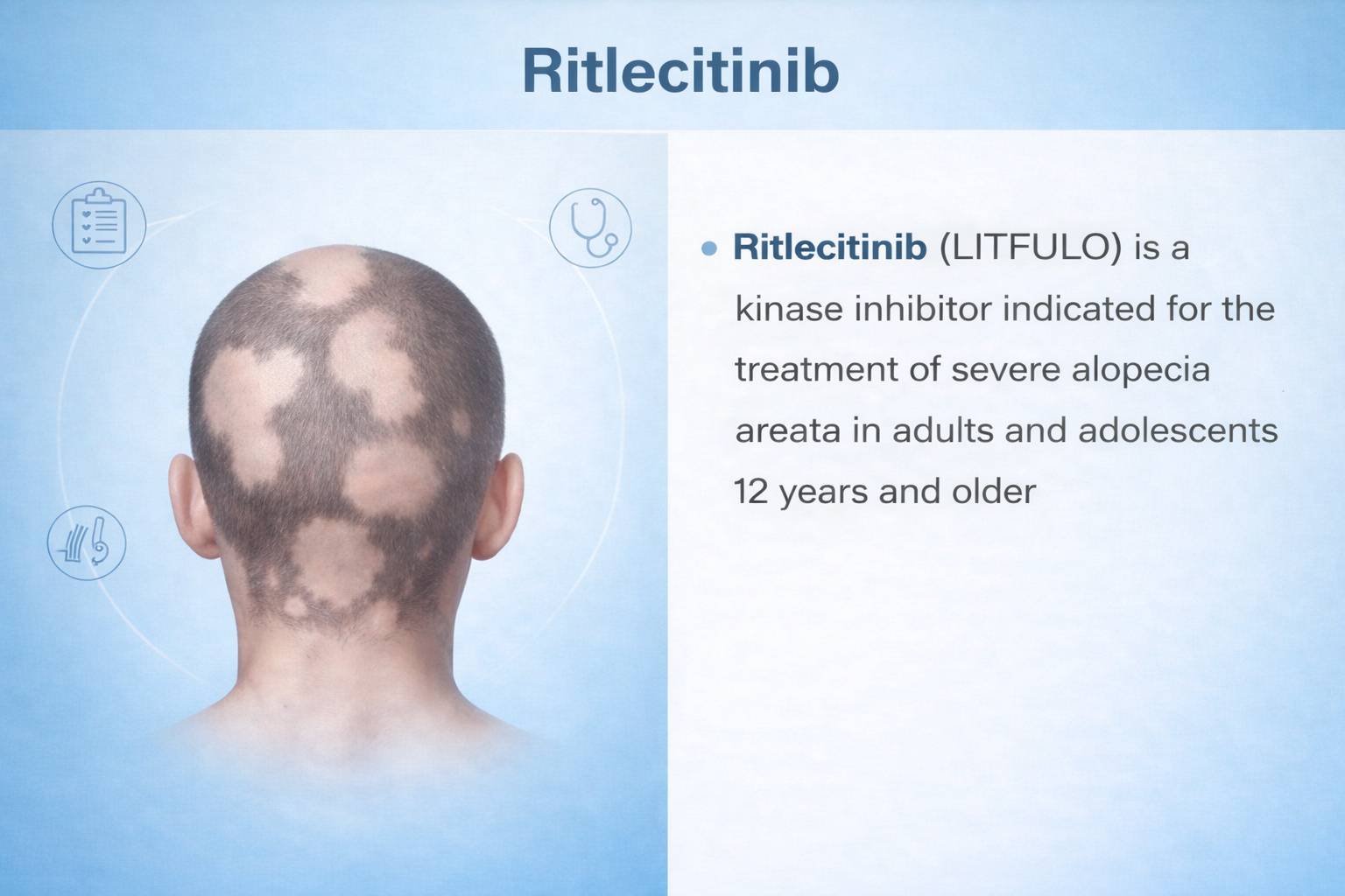 Ritlecitinib – TrialistMD